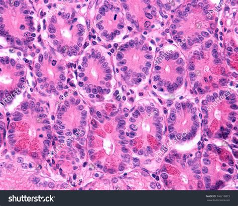 48 Crypts Of Lieberkuhn Royalty Free Photos And Stock Images Shutterstock