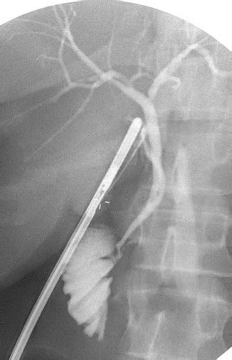 Rotation 1 2020 Simulated Surgical Experience Patient Docs 1 Une Mylearn