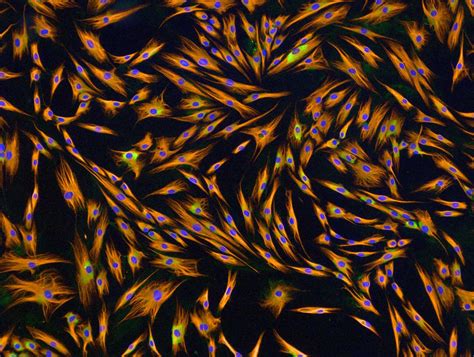 Watt Lab Research Image Human Dermal Fibroblasts