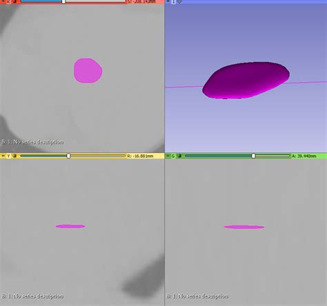Rtstruct Not Showing Contour Support 3d Slicer Community