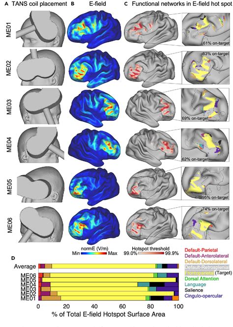 Figure 4 From Precision Mapping And Transcranial Magnetic Stimulation Of Individual Specific