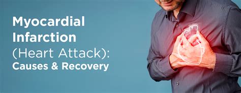 Myocardial Infarction Heart Attack Causes And Recovery Memon Medical Institute Hospital