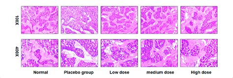 He Staining Of Bone Tissue With Different Doses Of Drugs Download Scientific Diagram