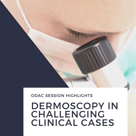 Using Dermoscopy To Diagnose Difficult Clinical Conditions Next Steps In Dermatology