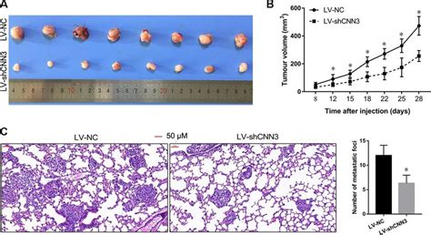 CNN Silencing Inhibits Tumor Growth And Lung Metastasis In Vivo A Download Scientific