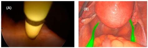 Journal Of Personalized Medicine Mdpi On Linkedin Intraoperative