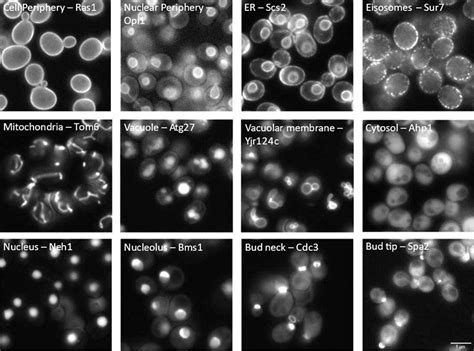 Yeast Protein Localization Classified Using Truai™ Deep Learning Technology Olympus Ls