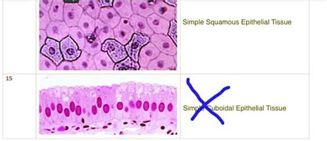 Solved Simple Squamous Epithelial Tissue Simi Cuboidal Epithelial Tissue