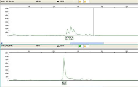 A Snapshot Showing Electropherogram Of Allele Size Difference Between