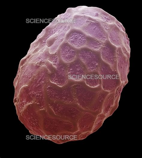 Nematode Egg Sem Stock Image Science Source Images