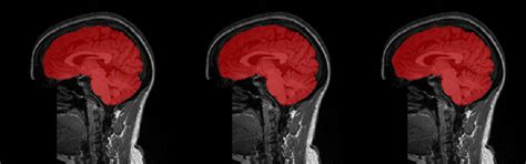 An Nfbs Image With Ground Truth Or Predicted Segmentation Masks Download Scientific Diagram