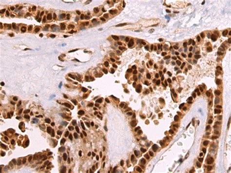 兔抗runx2多克隆抗体anti Runx2 Rabbit Polyclonal Antibody 生命科学产品与技术服务 生工生物工程