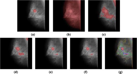 The Mini Mias Database Of Mammogram Number 063 A The Approximated