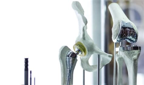 Nextgenerationimplants Medicalimplants Healthcaretechnology