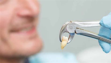 What To Do After Tooth Extraction Essential Tips