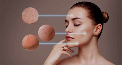 Get That Glow 10 Easy Ways To Even Out Skin Tone Nextmed Clinic