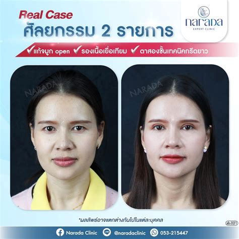 เปลี่ยนลุคสาวหน้าดุ ให้เป็นสาวสวยหน้าหวานละมุน ถ่ายรูปมุมไหนก็สวยเป๊ะ