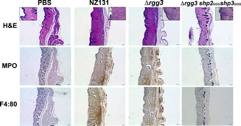 Identifying Genetic Determinants Of Streptococcus Pyogenes Host
