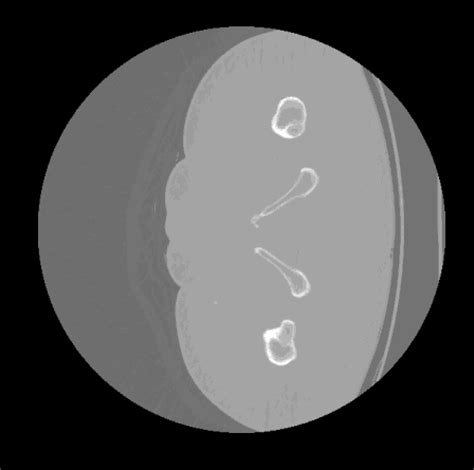Understanding Yolov5 Loss By Pablo García Mesa Medium
