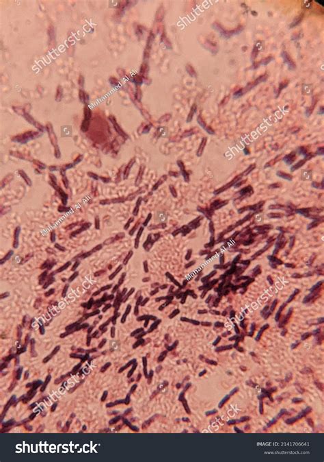 Microscope Slides Of Bacteria