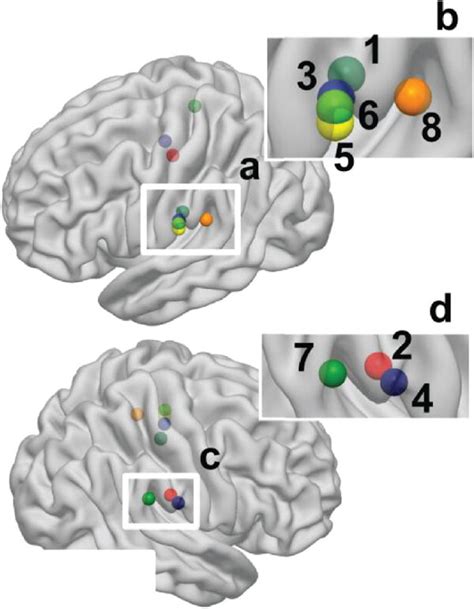 Cortical Activations Related To The Sensory Stimulation Task A Download Scientific Diagram