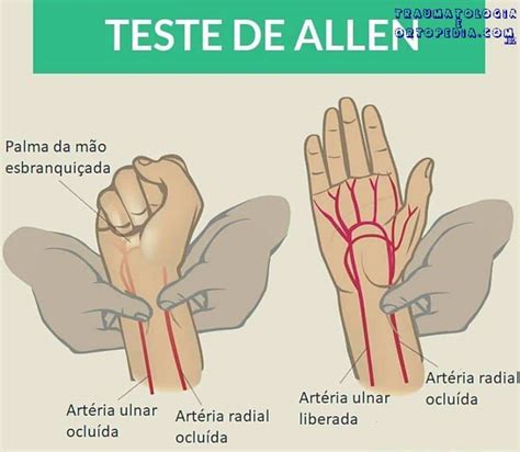 Allen Allen Allen And Allen At Michael Gates Blog