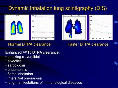 Ppt Comprehensive Guide To V Q Scintigraphy In Pulmonary Imaging Powerpoint Presentation Id