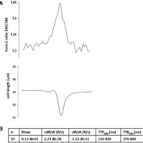 Calcium Transient Analysis In Induced Pluripotent Stem Cell Derived Download Scientific Diagram