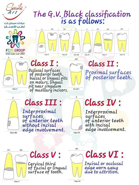 Classification Of Dental Fillings At Stephanie Watt Blog Classification Of Dental Fillings At Stephanie Watt Blog