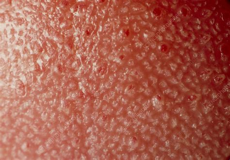 Macrophoto Of Surface Of Human Tongue Stock Image P4740002