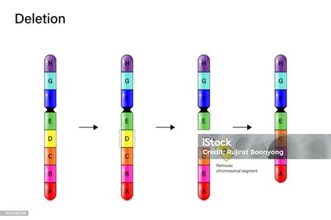 染色体欠失遺伝子変異染色体構造の変化科学的研究と生物学的遺伝学のためのベクトル 悪性腫瘍のベクターアート素材や画像を多数ご用意 悪性