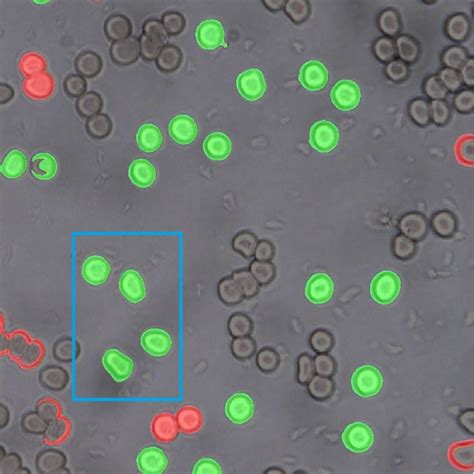 Elección de eritrocitos válidos Download Scientific Diagram