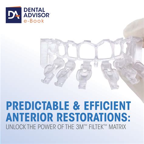 Matrix System Dental Advisor Matrix System Dental Advisor