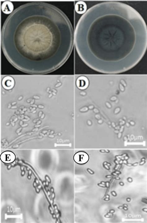 Morphological Characteristics Of Pseudocercosporella Fraxini Knu16 102 Download Scientific