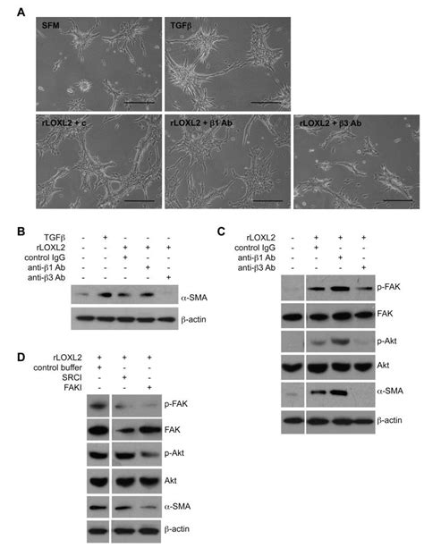 Tumor Secreted Loxl2 Activates Fibroblasts Through Fak Signaling Pmc