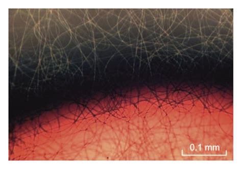 Nanofiber Matrices On The Si Sio2 Substrate With Deposited Au Contacts Download Scientific