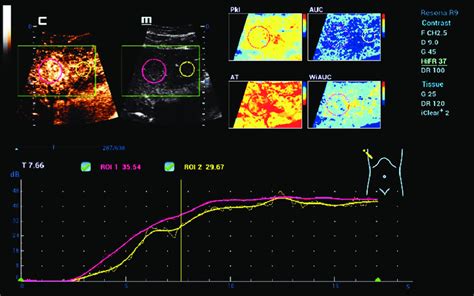 Color Coded Parametric And Time Intensity Curve Analysis Tic Of Download Scientific Diagram