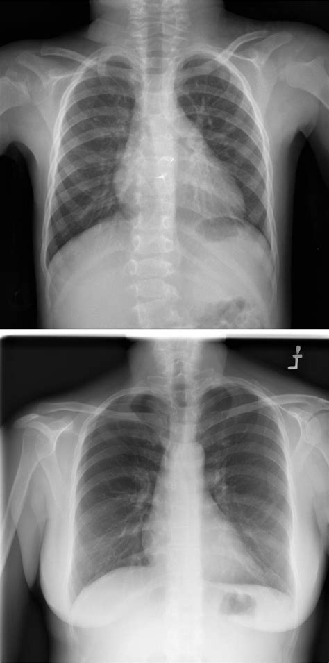 Figure 1 From Cascaded Latent Diffusion Models For High Resolution