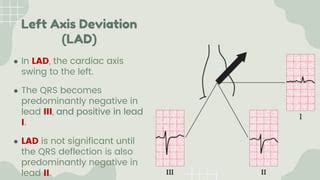 Cardiac Axis Simplified Pptx