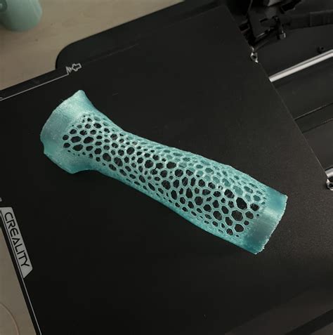3d Printer Arm Splint Forearm Splint Two Version • Made With Creality Ender 3 V3 Se・cults