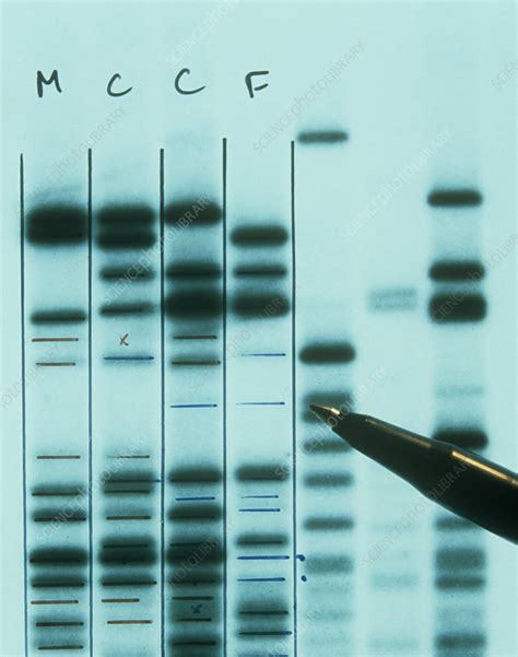 Dna Fingerprinting Stock Image G210 0229 Science Photo Library