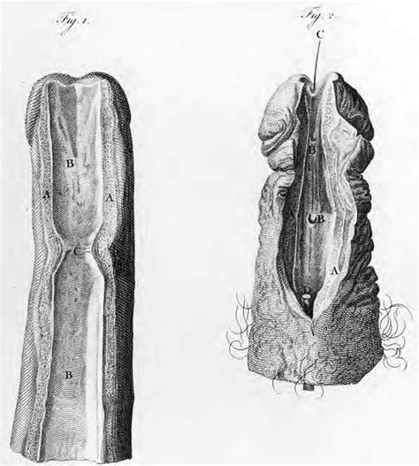 Subincision Aboriginal