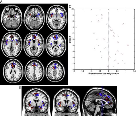 figure 2 from multivariate pattern classification reveals differential