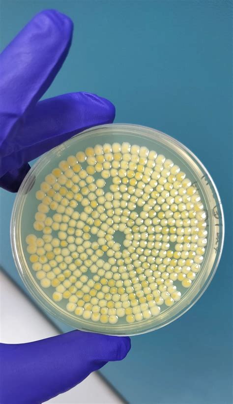 Om Prakash Choudhary On Linkedin Staphylococcus Aureus Colonies On Tsa