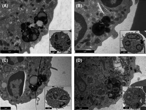 Green Neutrophil And Monocyte Inclusions Time To Acknowledge And