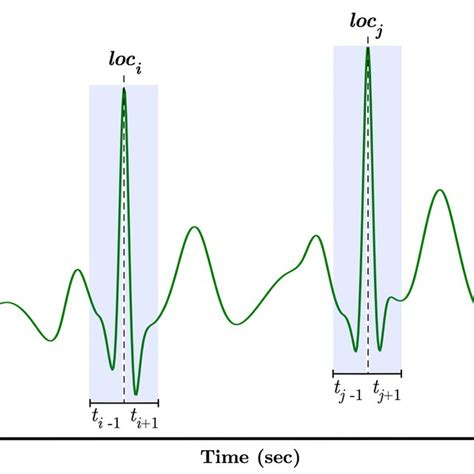 Moving Window Based Segmentation Approach Download Scientific Diagram