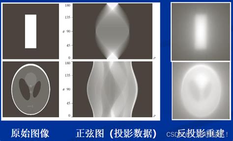 Radon变换 Csdn博客
