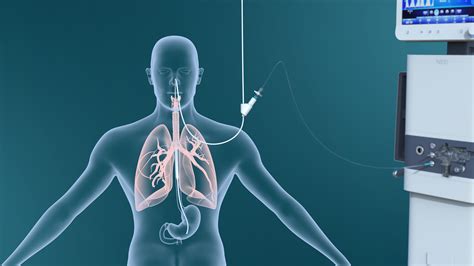 If Design Multifunctional Medical Detection Catheter