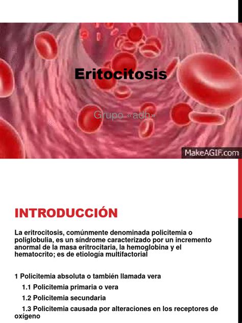 Eritrocitosis 170827044655 Pdf