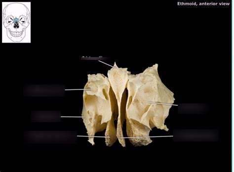 Skull Ethmoid Diagram Quizlet
